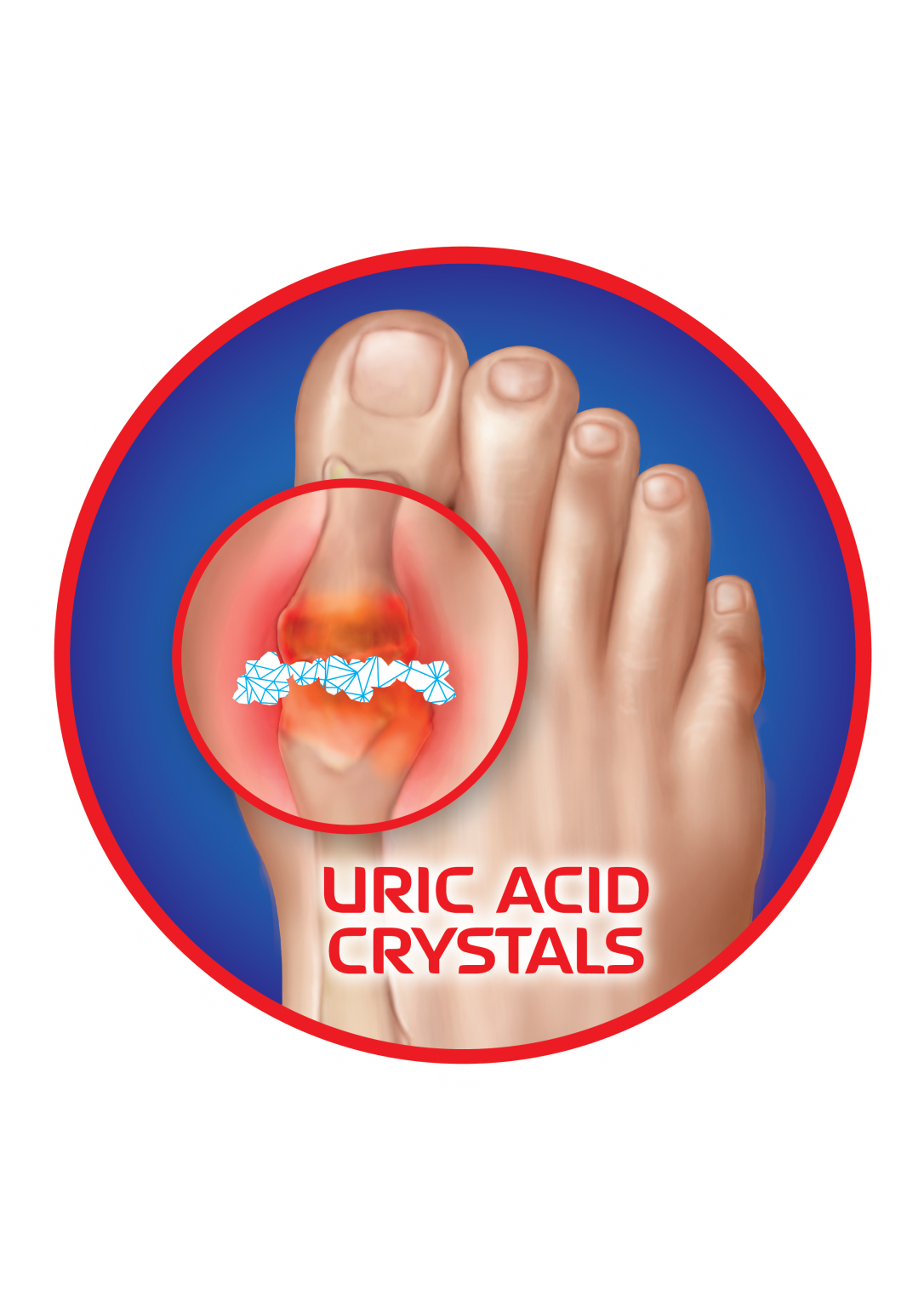 Clearogout | Gout Treatment & Lower Uric Acid Levels
